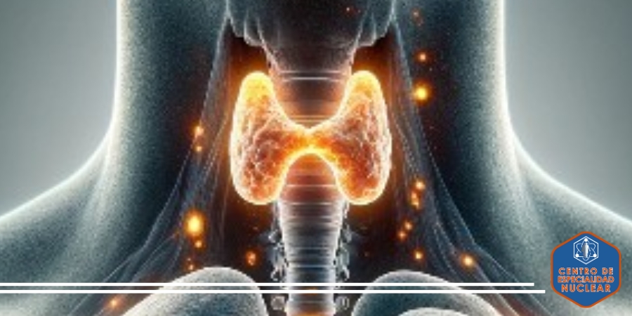 Tratamiento con Yodo Radiactivo 131I por Hipertiroidismo – Medicina ...